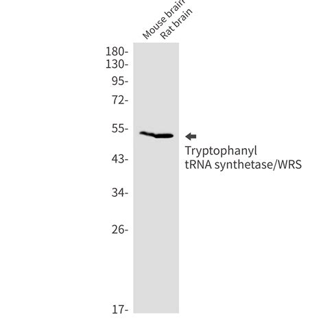 Tryptophan Trna Ligase Rabbit Mab Wb Ihc P Buy Now