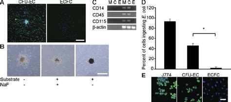 Monocytemacrophage Function In Cfu Ecs A Detection Of Cell Surface