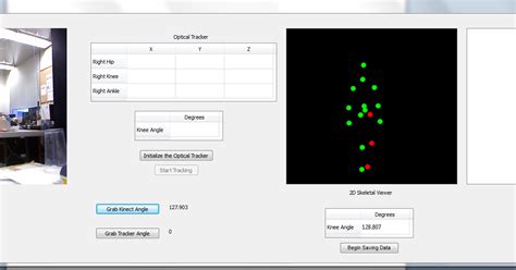 Image Primer Gait Analysis Using Kinect Sensor