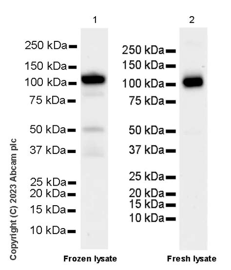 Anti Cbl Antibody 17c Cbl Ko Tested Ab309549 Abcam