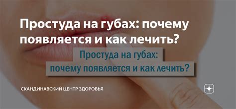 Простуда на губах: почему появляется и как лечить? | Скандинавский ...