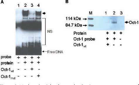 Figure 4 From Identification Of A Suppressor Element In The Amelogenin