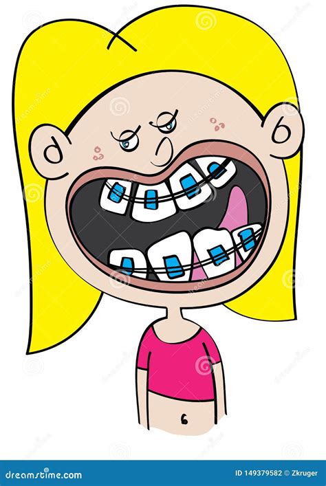 Unhealthy Teeth With Braces