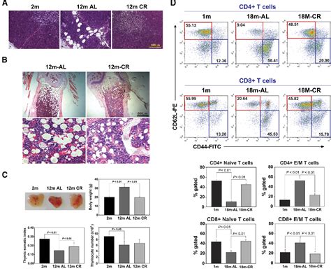 Figure 1 From Age Related Thymic Involution Restriction Is Coupled With Reduction In Inhibition