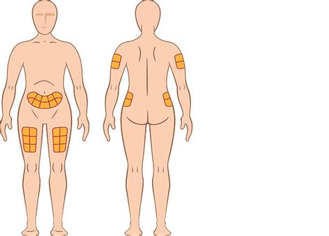 Intramuscular Injection Thigh