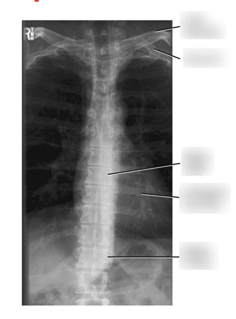 Ap T Spine Diagram Quizlet