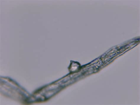 Lyme Nematomorphs Have A Threadworm Stage Which Easily Slips Through Your Body Tissues Views At