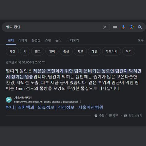 성인 땀띠 연고 오래 바르니까 좀 건조해요 네이버 블로그