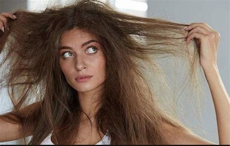 Descubrí En Qué Consiste El Extraño Síndrome Del Cabello Impeinable