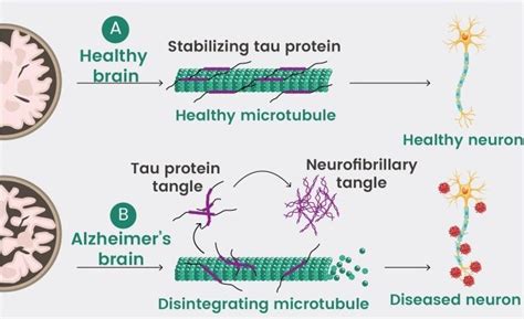 Signalchems Tau Proteins In Neurodegenerative Research