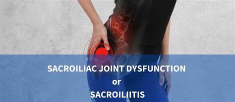 Sacroiliac Joint Dysfunction Or Sacroiliitis Symptoms Causes
