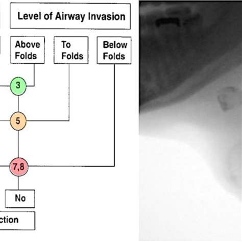 Modified Schematic Representation Of The Pas 13 Download Scientific