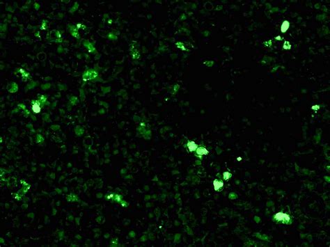 C1q Complement Fitc Diagnostic Biosystems Dbs