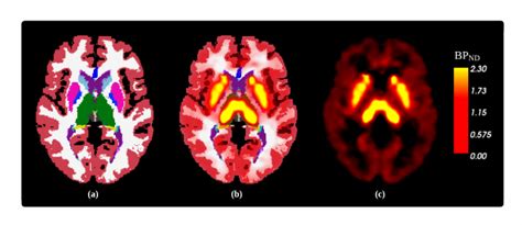 A Segmentation Of Subcortical Regions In Freesurfer B Segmentation Download Scientific