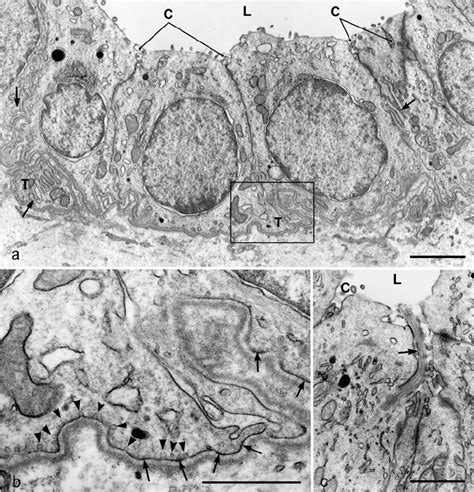 Interlobular Duct
