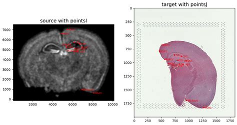 Aligning Single Cell Resolution Spatial Transcriptomics Data To Hande