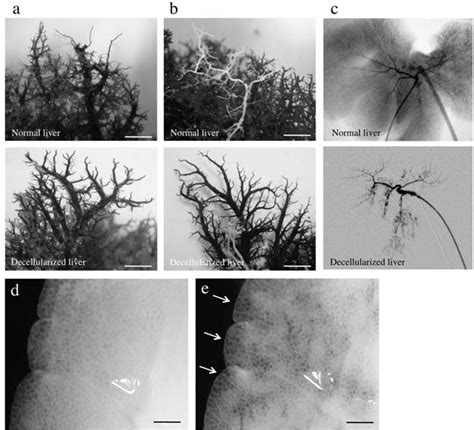 Decellularized Liver Matrix Preserves Entire Vascular System And Bile
