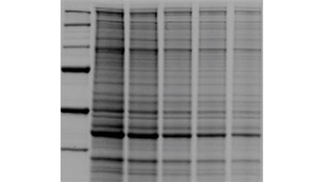 Western Blotting Western Blot Normalization Using Image Lab Software