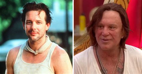 Inside Mickey Rourkes Extensive Plastic Surgery Journey