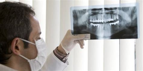 Aggressive Parodontitis Was Ist Das