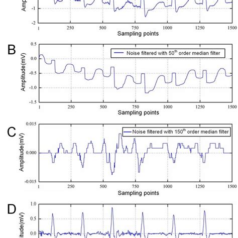 Processing Process To Remove Baseline Drift Noise Of Ecg Signals A