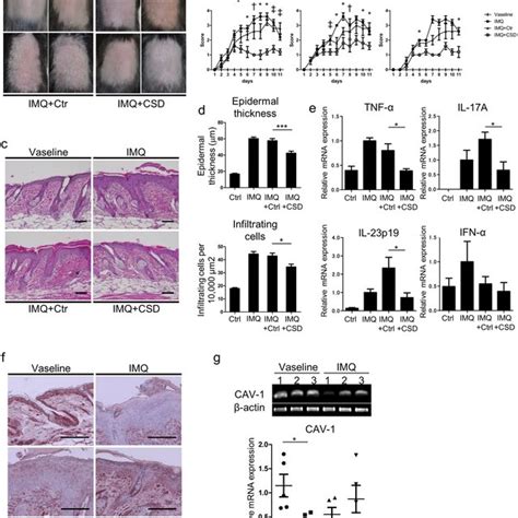 Phenotype Of Imq Induced Murine Model Of Psoriasis Like Skin