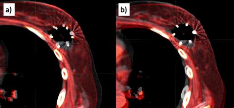 Difference In Registration Methods A The Registration Image In Which