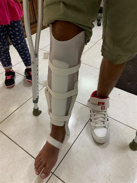 Dr Foot Sarmiento De Tibia Para Una Mejor Consolidación