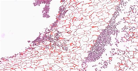 Pc3 Cell Line Prostate Cytomatrix