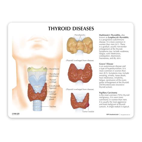 Human Anatomy Thyroid Model Set With Larynx For Medical Education In