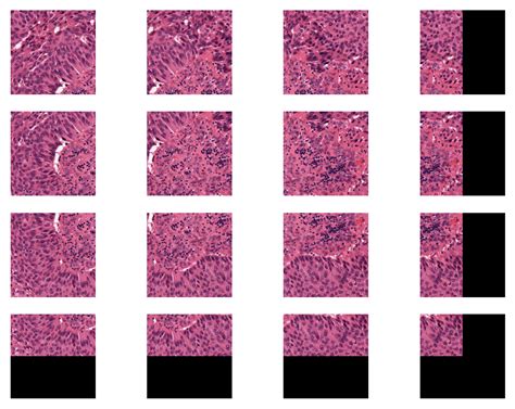 Patch Extraction From Histology Images Tia Toolbox 160 Documentation