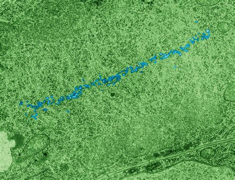 Phragmoplast Expansion Requires α Aurora Nature Plants