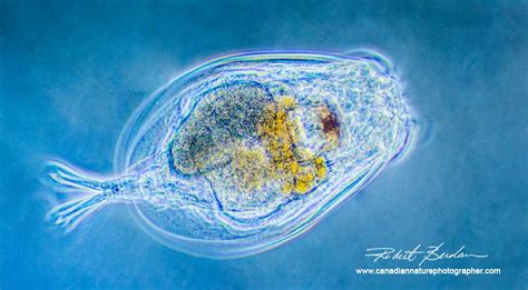 Microorganisms In Pond Water Under Microscope