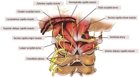 Occipital Neuralgia Neuropedia
