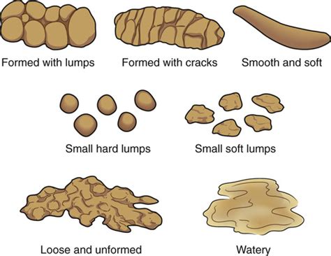 Soft Stool Bowels