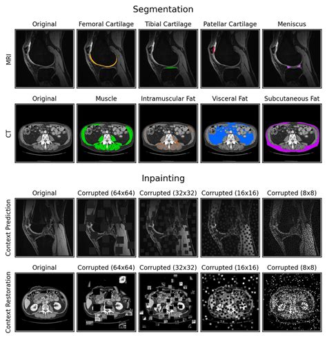 Example Ground Truth Segmentations For The Mri And Ct Datasets Both