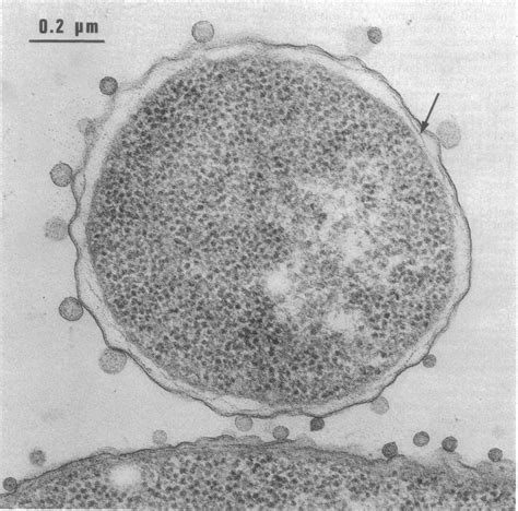 Electron Micrograph Of A Thin Section Of The Lpp Ompa Double Mutant Download Scientific Diagram