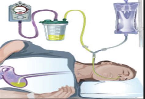 Pediatric Poisonings And Toxidromes Flashcards Quizlet