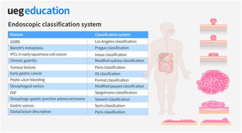 Ueg Endoscopic Classification Systems Are Widely Available And Can Help Classify Endoscopic