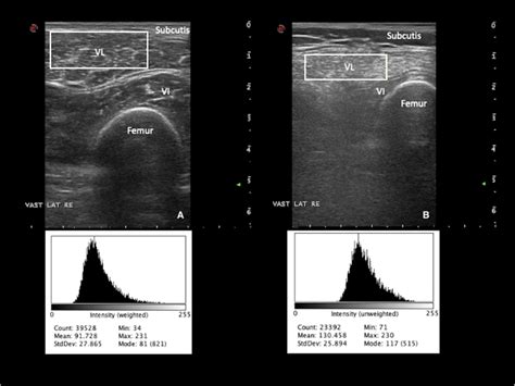 Quantitative Grayscale Analysis In A Healthy A And Diseased Muscle Download Scientific