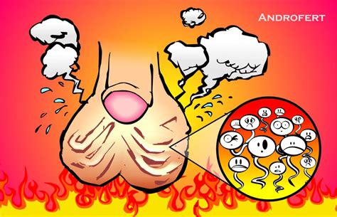 Varicocele Androfert Clinica De Andrologia E Reprodução Humana