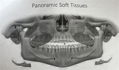 Dh103 Panoramic Soft Tissues Labeling Diagram Quizlet