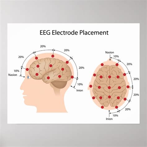 Eeg Electrode Placement Map At William Jennings Blog
