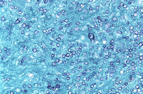 Histoplasma Capsulatum Fungi Poster By Cdc Dr Libero Ajelloscience