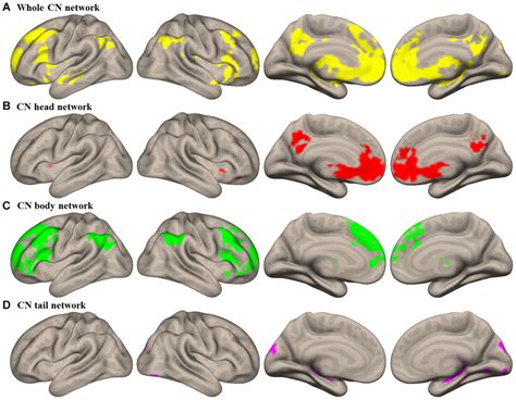 Differential Functional Dysconnectivity Of Caudate Nucleus Subdivisions