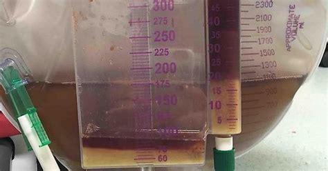 Uroseptic Much Rnursing