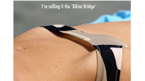 Social Media The ‘bikini Bridge And The Viral Contagion Of Body Ideals