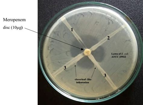 Phenotypic Detection Of Carbapenemase Production By The Modified Hodge Download Scientific