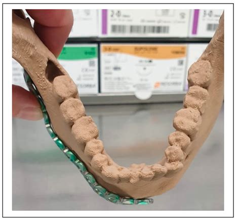 Introduction Of 3d Printing In A German Municipal Hospital—practice