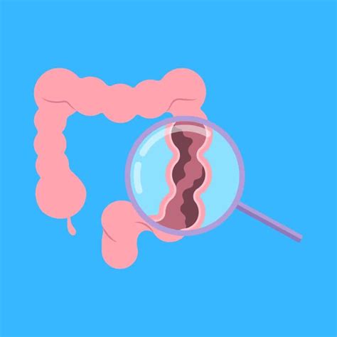 30 Funny Colonoscopy Jokes Heres A Joke